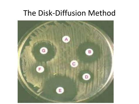 Disk Diffusion Method Microbiology At Patricia Bartholomew Blog