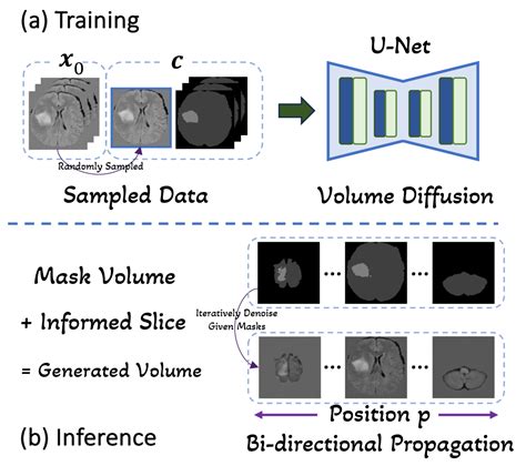 3d Mri Synthesis With Slice Based Latent Diffusion Models Improving Tumor Segmentation Tasks In