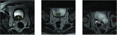 Some Failed Segmentation Result Where The Green And Red Line Indicate Download Scientific