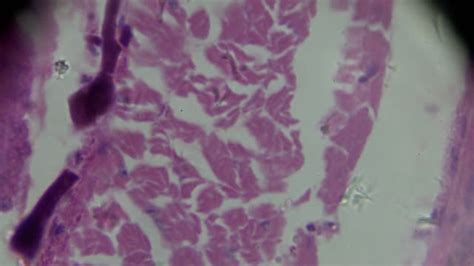 Earthworm Cross Section Videos And Hd Footage Getty Images