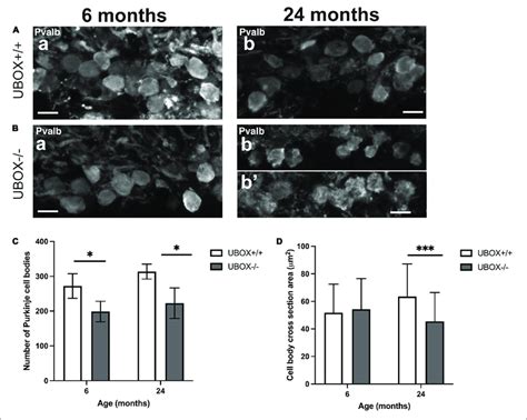 The Number And Size Of Purkinje Cell Bodies Are Progressively Reduced