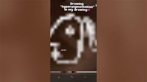 Drawing Hyperpigmentation In My Drawing Youtube