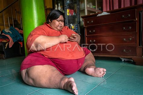 Penderita Obesitas Di Indonesia Antara Foto