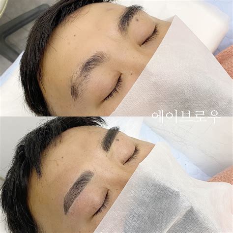 켈로이드 눈썹문신 주의할 점과 관리 방법 Trang Chủ