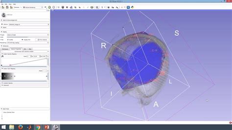 Volume Clipping Cropping With Model On Slicer 3d Youtube