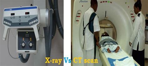 Difference Between X Ray And CT Scan With Comparison Chart Bio Differences