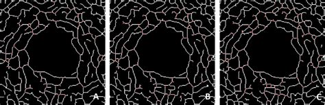 Assessment Of A Novel Semi Automated Algorithm Opth