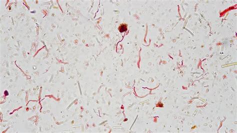 Microscopic Slide With Sperm Smear 400x Against Bright Field Background Science Stock Footage