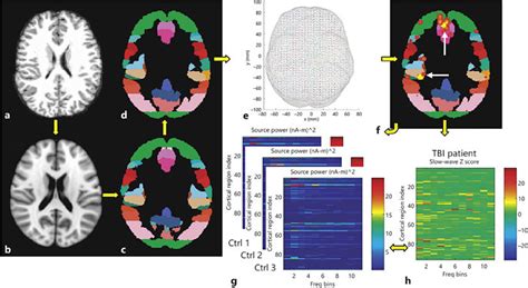 Processing Stream Of Frequency Domain Vestal Meg Source Imaging For Download Scientific Diagram