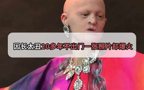 女孩长相奇丑20多年不敢出门为何却因一张照片爆火 哔哩哔哩