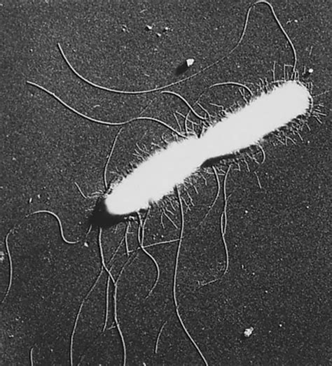 Salmonella Typhimurium Bacteria Britannica