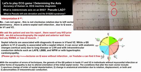 Dr Nabil Paktin s Cardiology Blog مجله کاردیولوژی دکتور نبــیل پاکطـین Let s to play ECG game