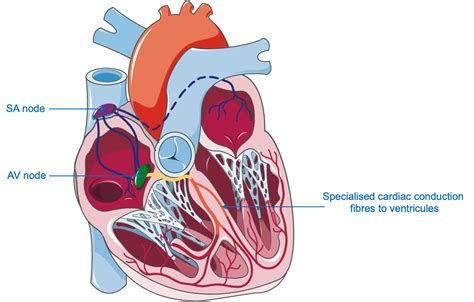 Pace And Ablate Part 1