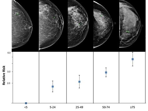 Breast Density Research In Dceg Nci