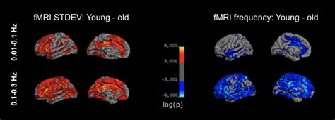 Gamma Band Activity In Human Posterior Parietal Cortex 55 Off