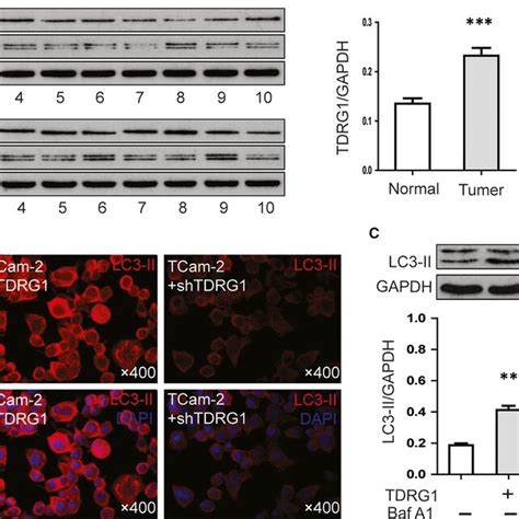 Testis Developmental Related Gene 1 Tdrg1 Promotes Autophagy In Both Download Scientific