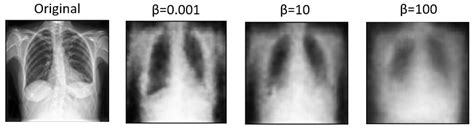 Mv Mff Multi View Multi Feature Fusion Model For Pneumonia Classification