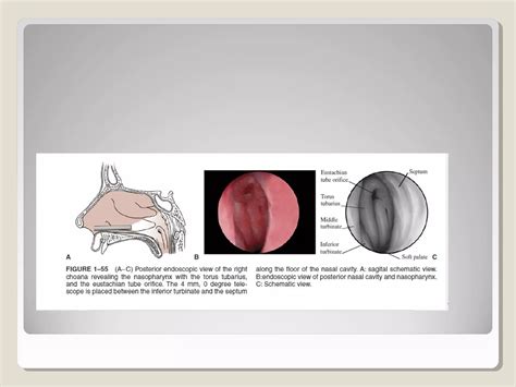 Endoscopic Nasal Anatomy Ppt