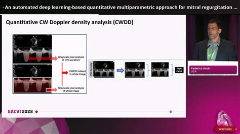 Esc 365 An Automated Deep Learning Based Quantitative Multiparametric Approach For Mitral