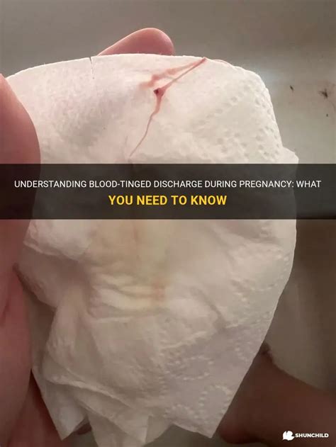 Understanding Blood Tinged Discharge During Pregnancy What You Need To