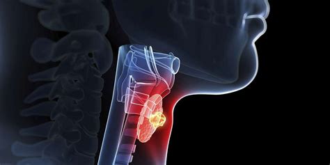 Contractive Pills And Thyroid It Has Been Evidently Proven That The