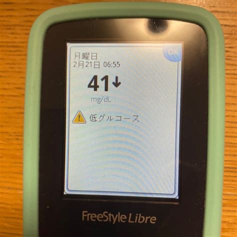 リブレ交換 劇症1型糖尿病になったゆー