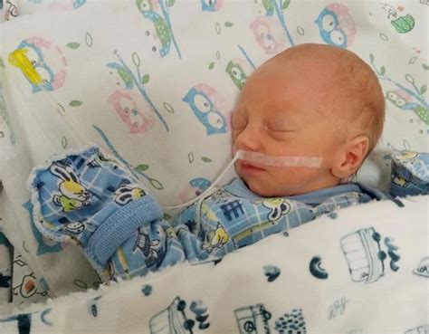 У Львові медики неонатального центру врятували недоношене немовля історія породіллі з Київщини