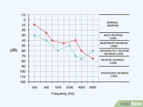 How To Read An Audiogram Steps With Pictures WikiHow