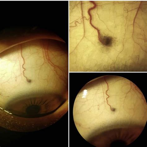 Photo Credit Ophthalmology Notes And Synopses