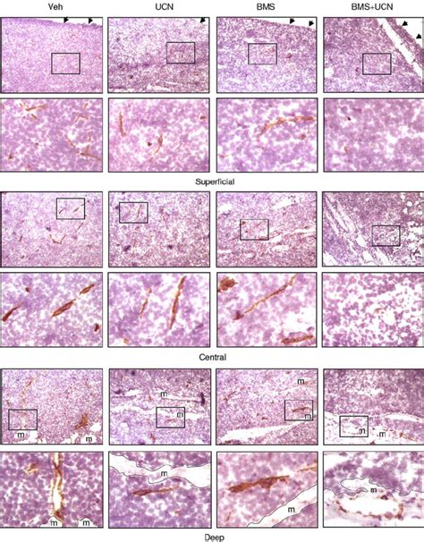 Coadministration Of Bms354825 And Ucn 01 Inhibits Angiogenesis In Vivo