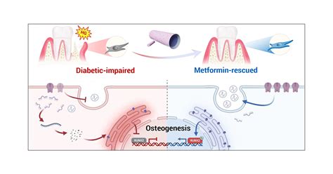 Nanocarrier Assisted Delivery Of Metformin Boosts Remodeling Of