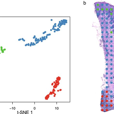 Dimensionality Reduction Of The Gene Expression Data Obtained From The Download Scientific