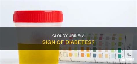 Cloudy Urine A Sign Of Diabetes Medshun