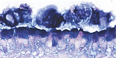 Welcome To The Marsico Lung Institute Unc Cystic Fibrosis Center Marsico Lung Institute