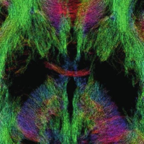 a diffusion tensor imaging at 0 8 mm isotropic resolution on the download scientific diagram