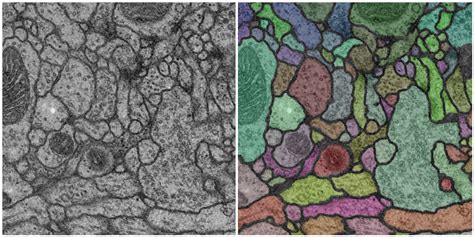 Segmentation Of Neuronal Structures In Em Stacks Challenge Isbi
