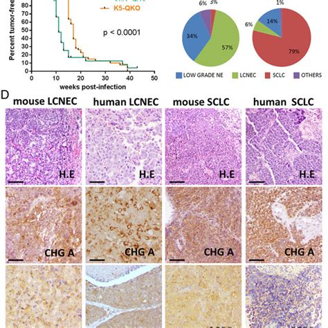 Gene Expression Analyses Of Sclc Tumors Arising From K5 Qko Mice Download Scientific Diagram
