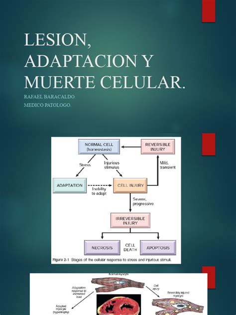 Lesión Y Adaptación Celular En Patología Pdf Inflamación Sistema