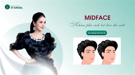 Midface Khám Phá Cách Trẻ Hóa đôi Mắt Và Tạo đường Nét Tươi Trẻ