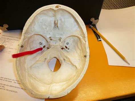 Foramen Spinosum
