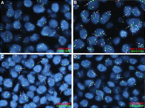 Representative Fluorescence In Situ Hybridization Fish Results For