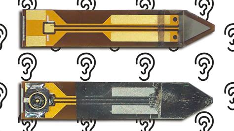 Implantable Microphone Could Lead To Fully Internal Cochlear Implants Todays Medical Developments