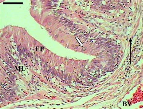 Section Of Adult Distal Intestine Showing More Goblet Cells White Download Scientific Diagram