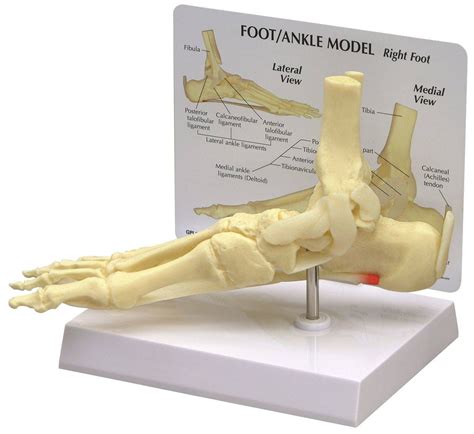 3b Scientific Hollow Foot Pes Cavus Anatomy Model