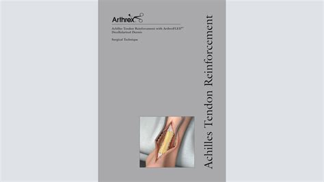 Arthrex Arthroflex® Decellularized Dermal Allograft