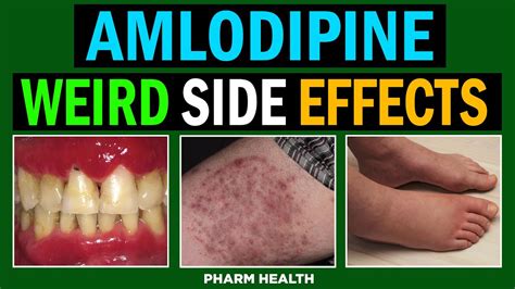 8 Weird And Unexpected Side Effects Of Amlodipine Skin Gastrointestinal Psychological Youtube