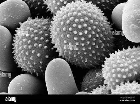 Rose Rust Fungal Spores Scanning Electron Micrograph Of Reproductive Spores Known As