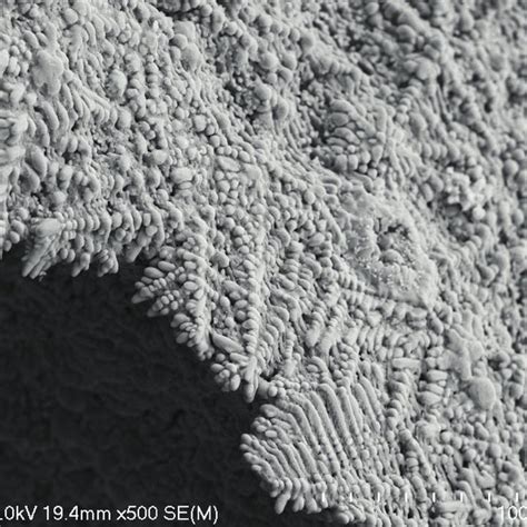 Dendritic Microstructure Sem Microphotography Slag From The Electric