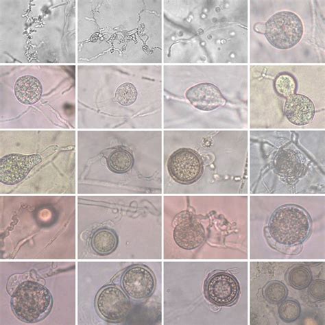 Pdf Two New Pythium Species From China Based On The Morphology And Dna Sequence Data