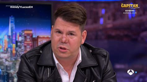 Lucas De Andy Y Lucas Se Rompe Al Hablar De Su Operación De Nariz